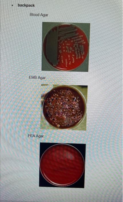 Solved EMB Agar PEAAgarLaboratory Activities: 1. Specimens | Chegg.com