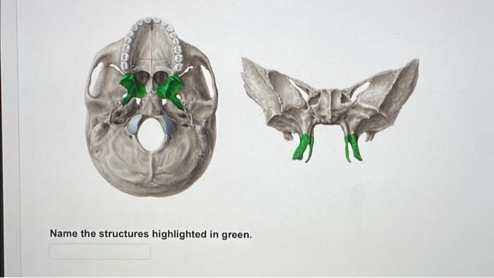 Solved Name the structures highlighted in green. | Chegg.com
