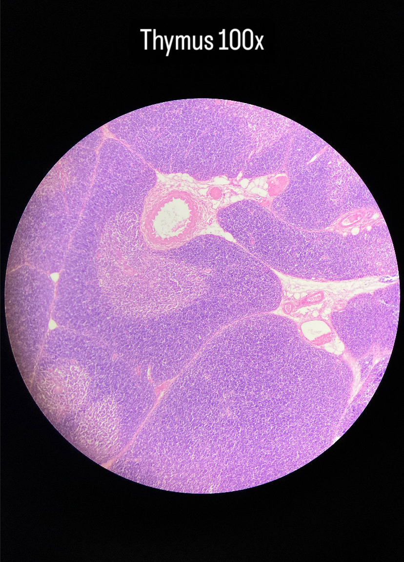 Solved Thymus 100x Label on the slide please | Chegg.com