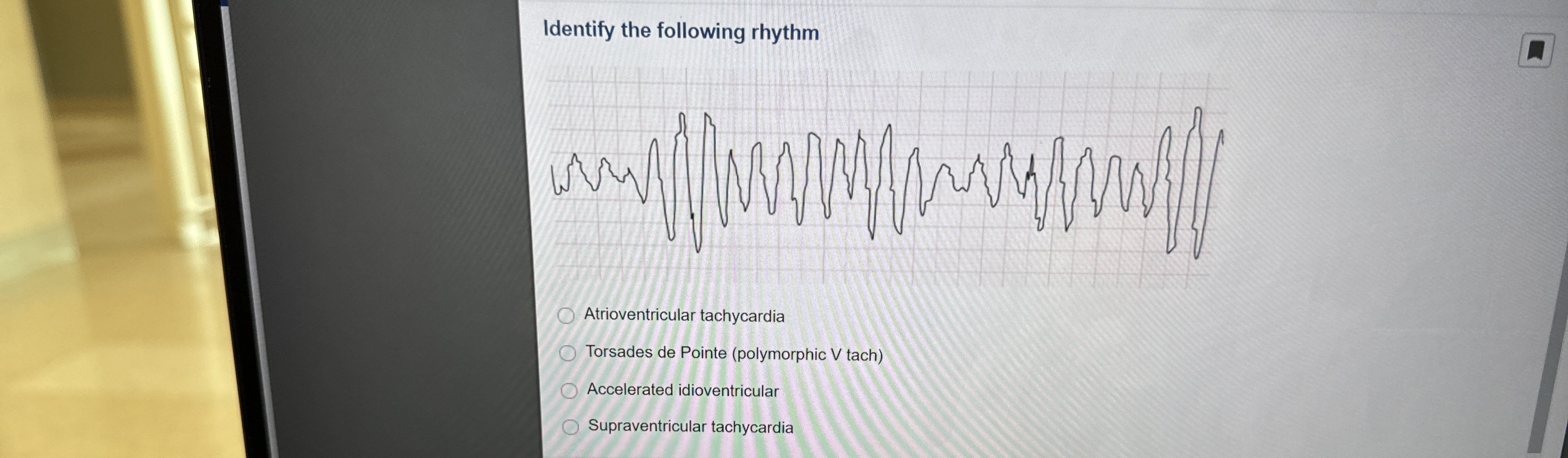 Solved Identify the following rhythmAtrioventricular | Chegg.com