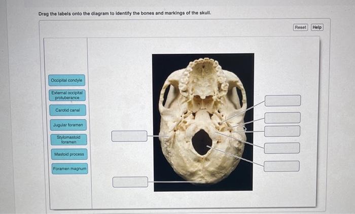 Solved Mandibular fossa Incisive fossa Maxilla Foramen | Chegg.com