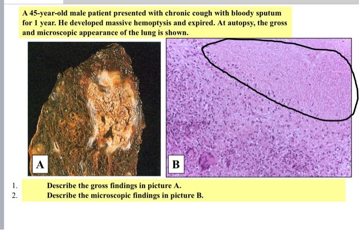 Solved Describe the gross findings in picture A.Describe the | Chegg.com