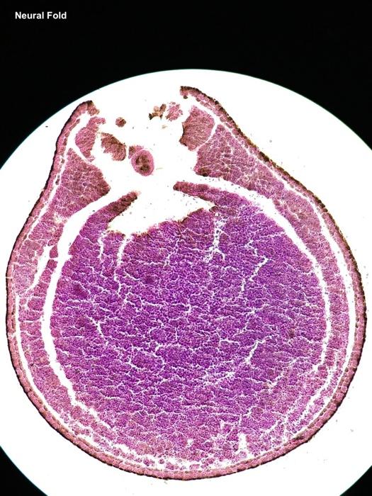 Solved Neural Tube Neural Fold | Chegg.com