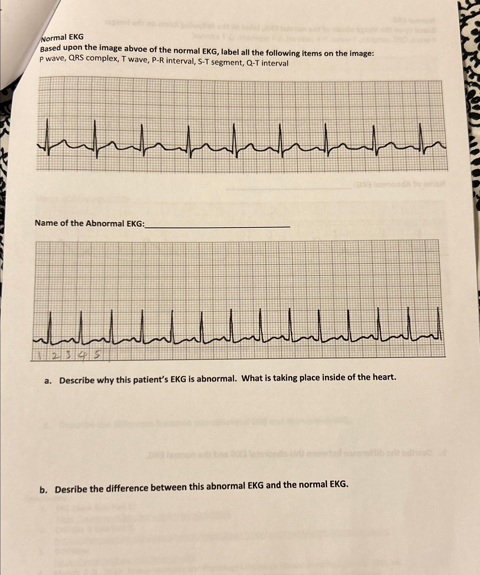 Solved Normal EKGBased upon the image abvoe of the normal | Chegg.com