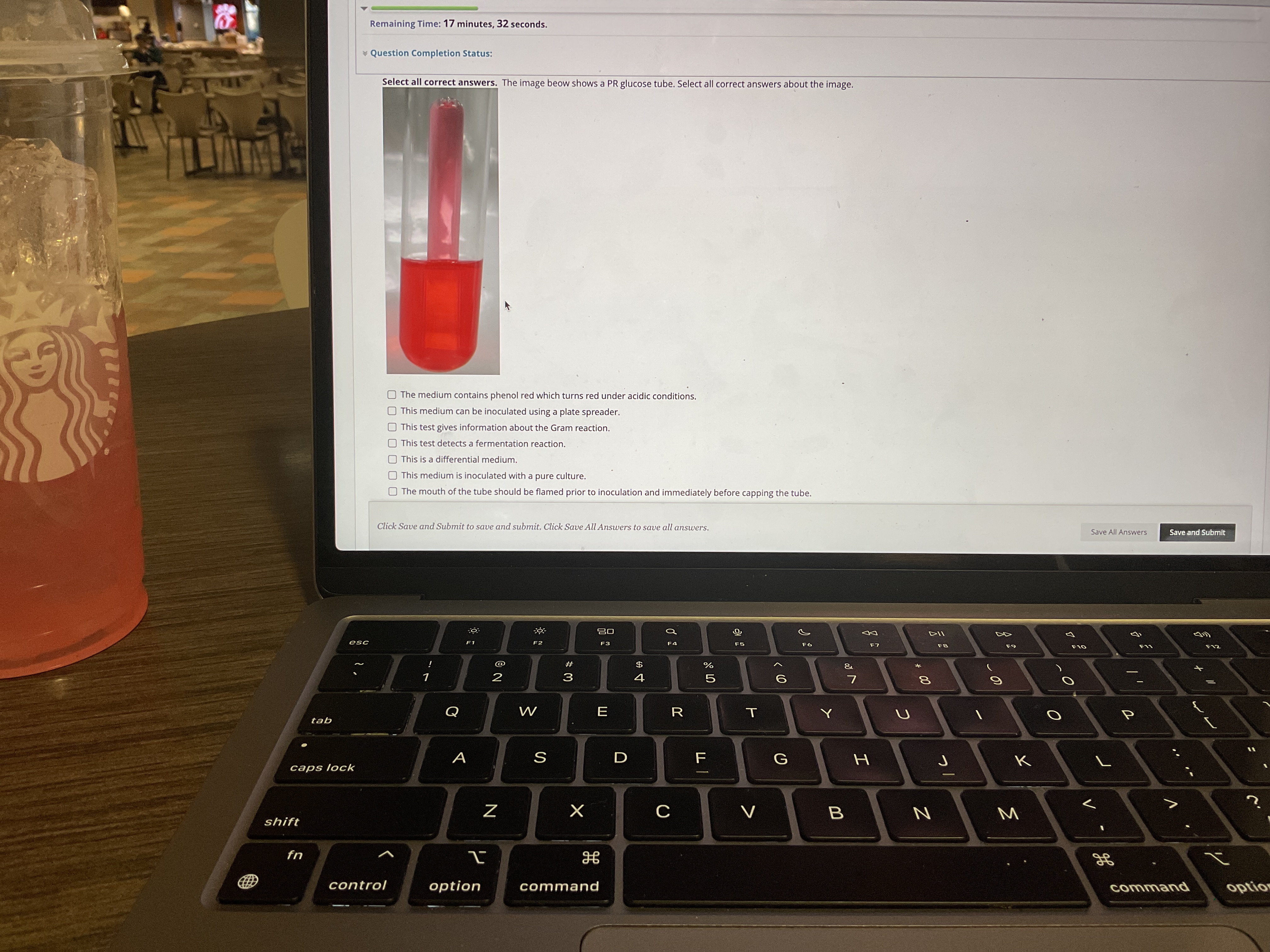 Solved The image below shows a pr glucose tube select all | Chegg.com