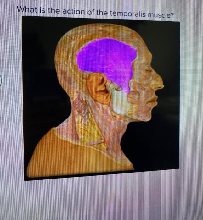 Solved What is the action of the temporalis muscle? | Chegg.com