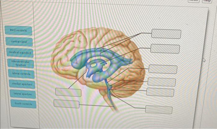 please match all 4 questions label exercises1)2)3)4) | Chegg.com