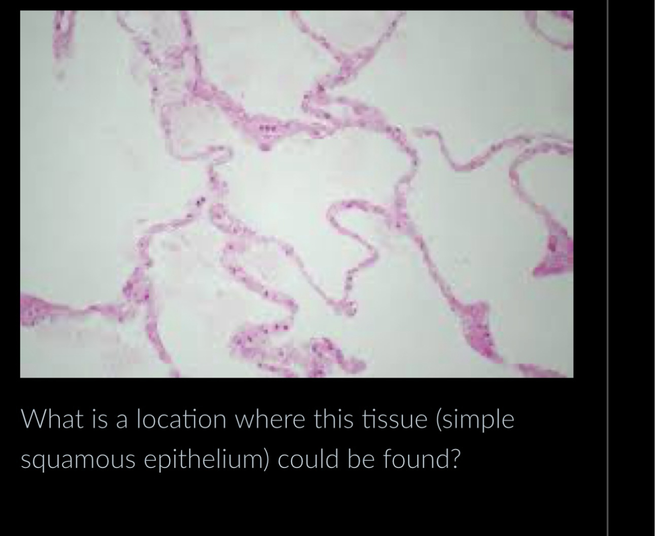 Solved What is a location where this tissue (simple squamous | Chegg.com