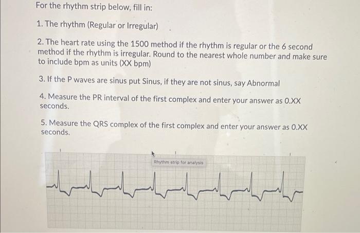 Solved For the rhythm strip below, fill in: 1. The rhythm | Chegg.com