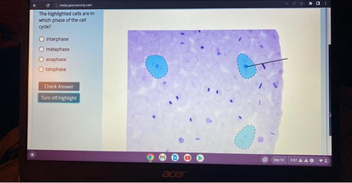 Solved The highlighted cells are in which phase of the cell | Chegg.com