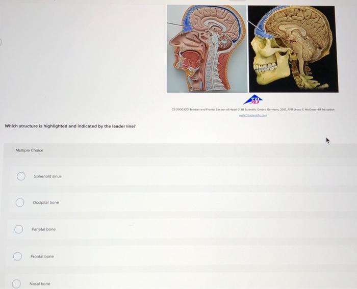 Solved Which structure is highlighted? Multiple Choice | Chegg.com