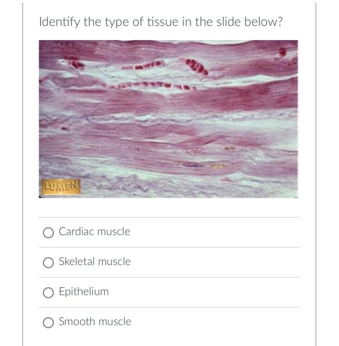 Solved Identify the type of tissue in the slide below? | Chegg.com
