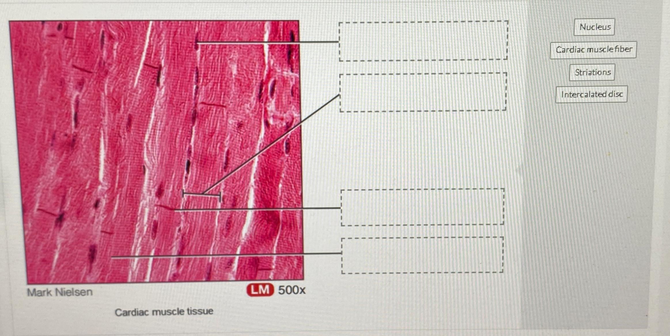 Solved NucleusCardiac musclefiberStriationsIntercalated | Chegg.com