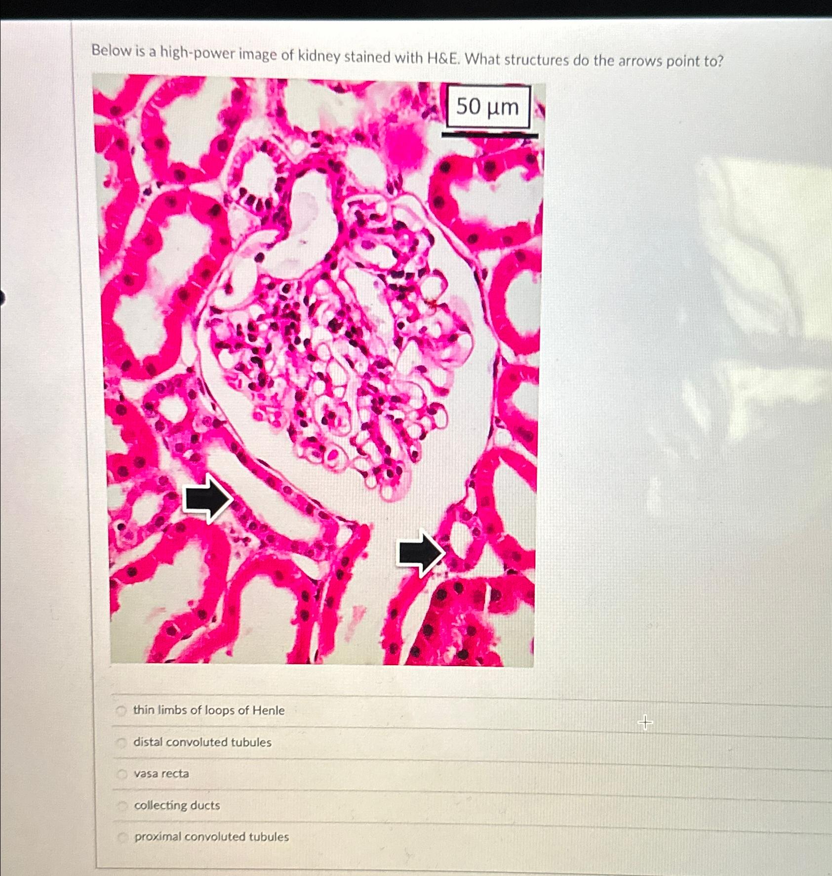 Solved Below is a high-power image of kidney stained with | Chegg.com