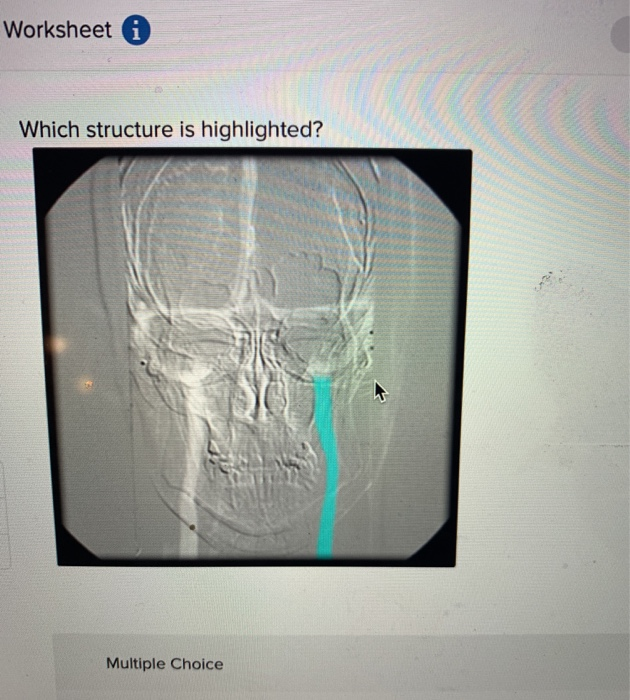 Solved Worksheet Which structure is highlighted? Multiple | Chegg.com