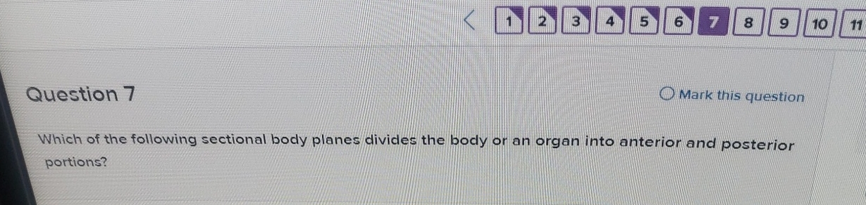 Solved Question 7Which of the following sectional body | Chegg.com