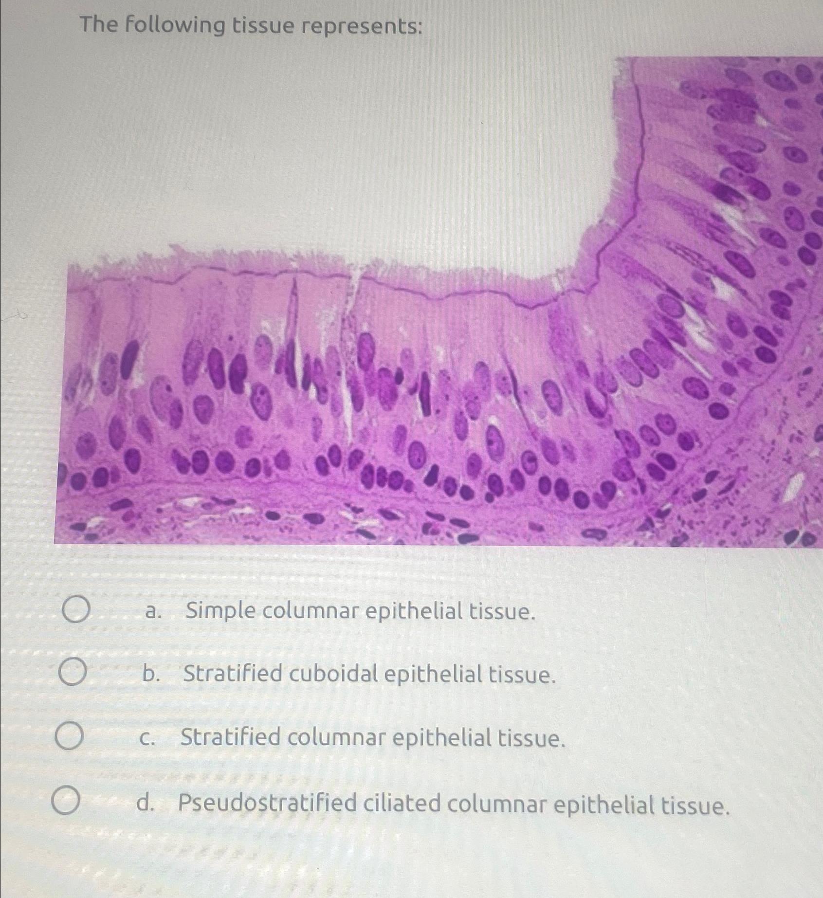 Solved The following tissue represents:a. ﻿Simple columnar | Chegg.com