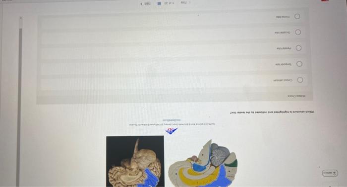 Solved Which structure is highlighted and indicated by the | Chegg.com