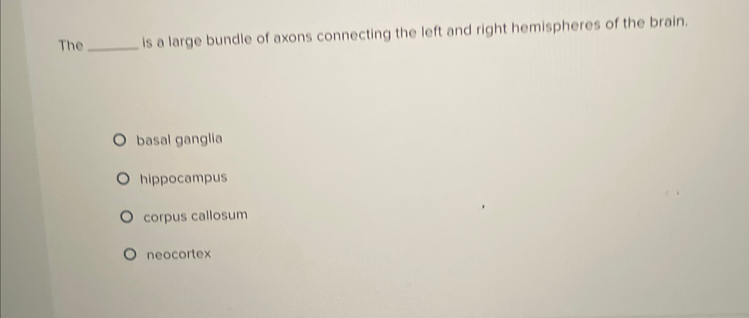 Solved The ﻿Is a large bundle of axons connecting the left | Chegg.com