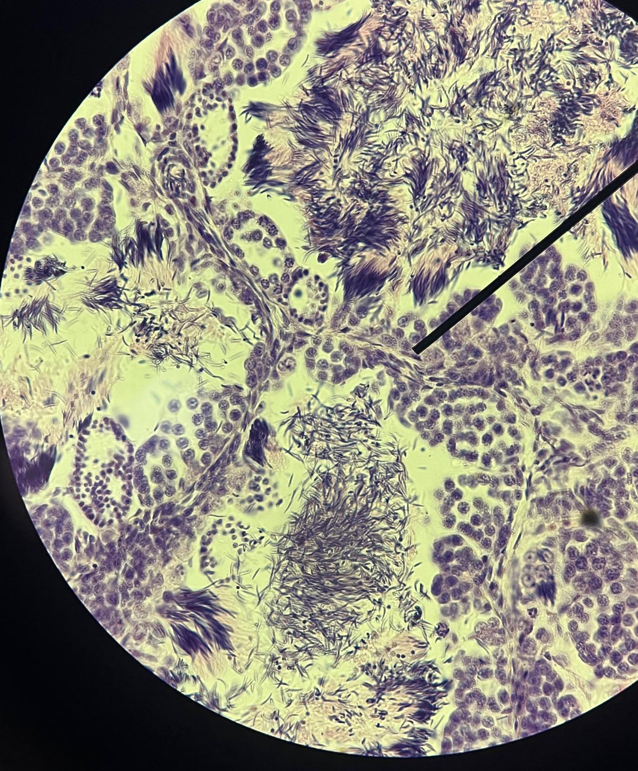Solved Please label the parts of this frog testes specimen | Chegg.com