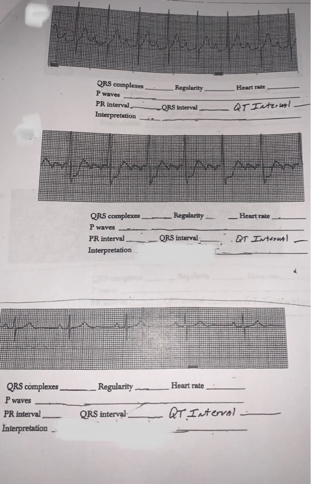 WWWAAAA Regularity Heart rate QRS complexes P waves | Chegg.com