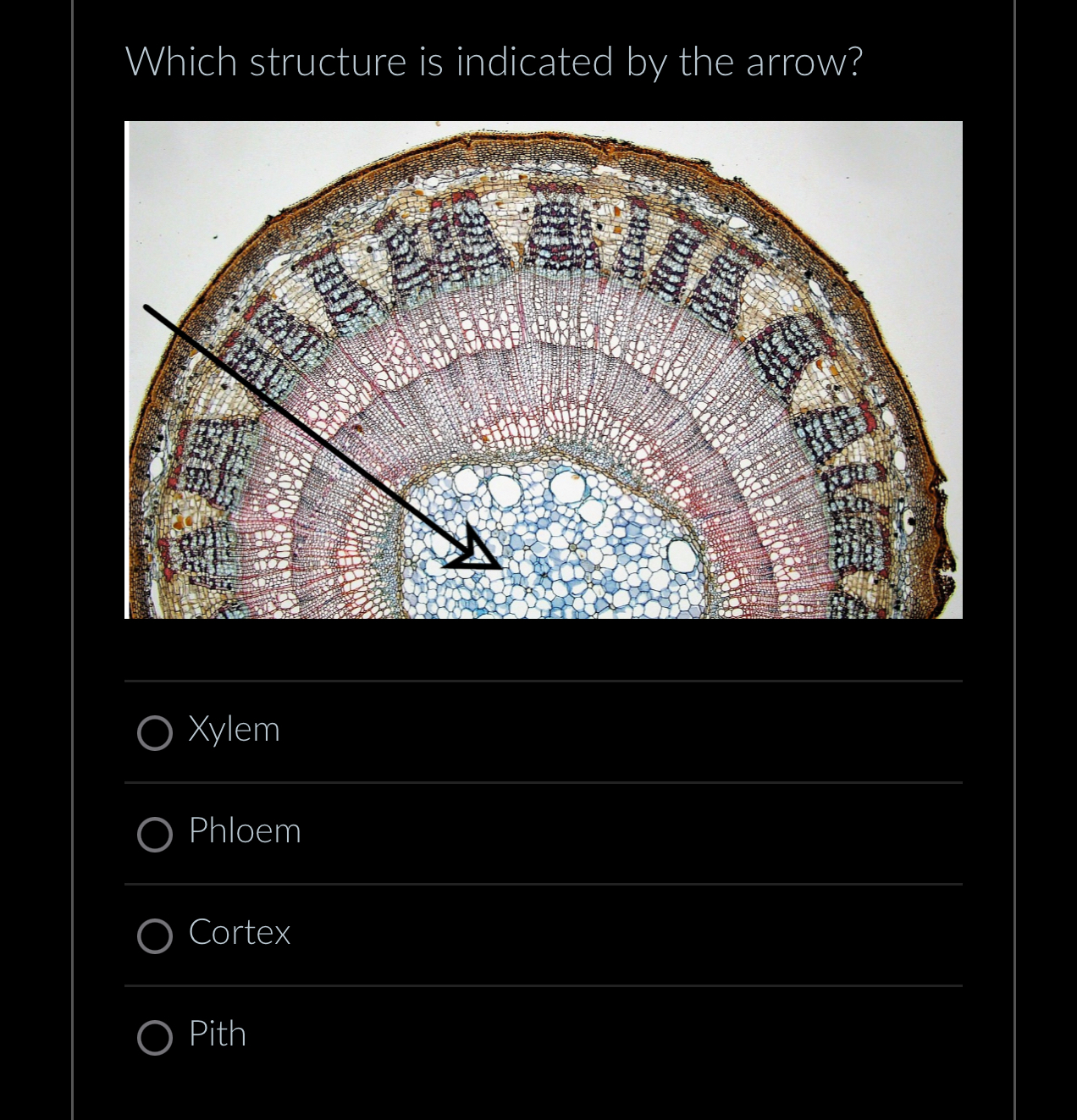 Solved Which structure is indicated by the | Chegg.com