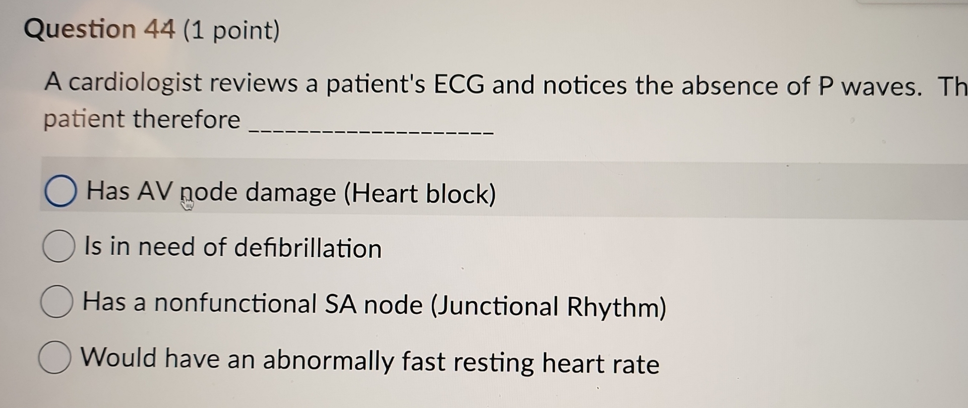 Solved Question 44 (1 ﻿point)A cardiologist reviews a | Chegg.com