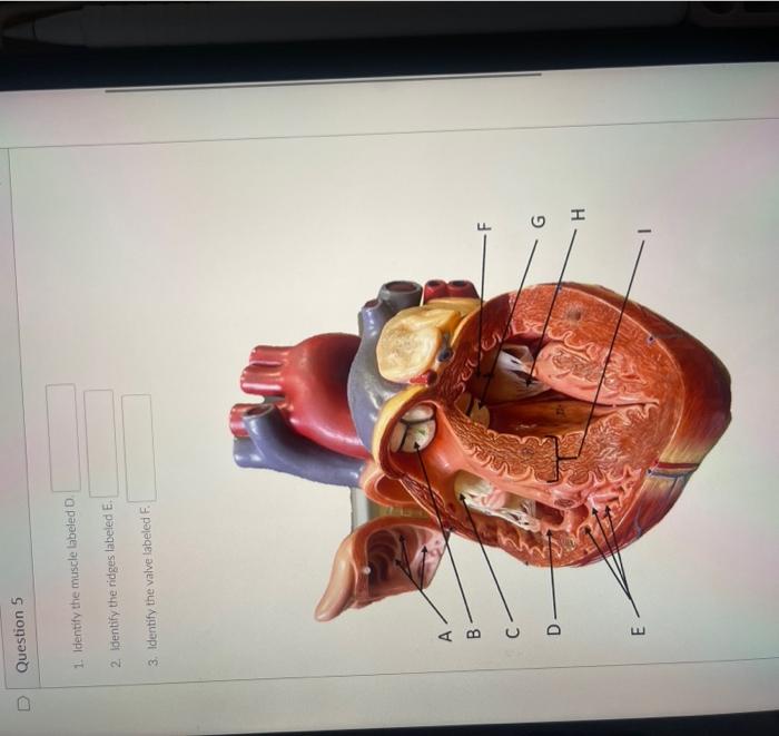Solved 1. Identify the blood vessel labeled A. 2. Identify | Chegg.com