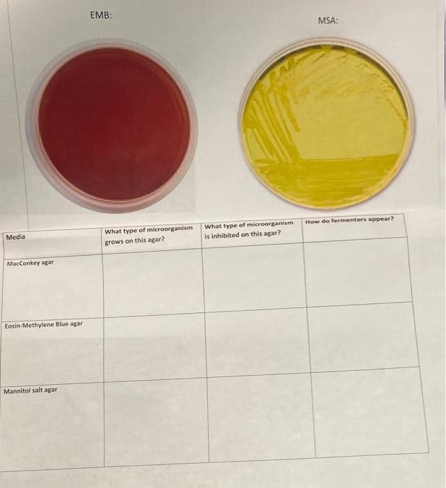 Solved EMB: MSA: How do fermenters appear? What type of | Chegg.com