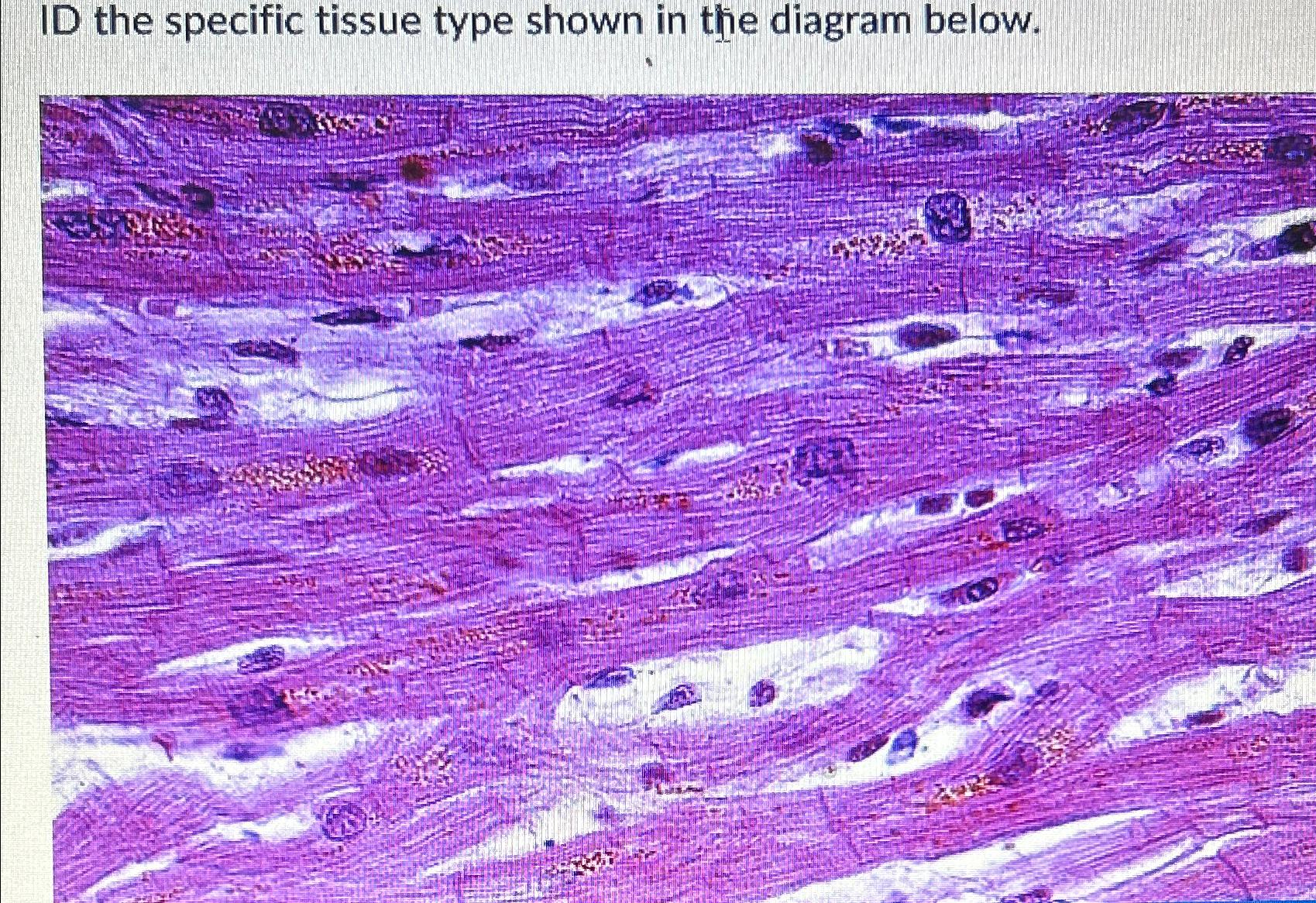 Solved ID the specific tissue type shown in the diagram | Chegg.com