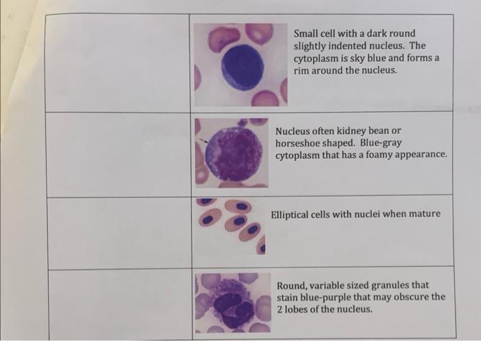 Solved Small cell with a dark round slightly indented | Chegg.com