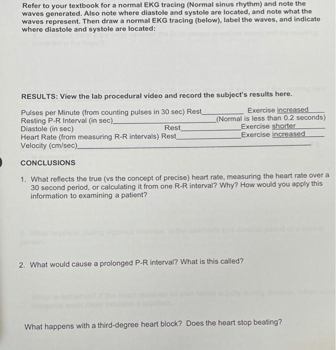 Solved Refer to your textbook for a normal EKG tracing | Chegg.com