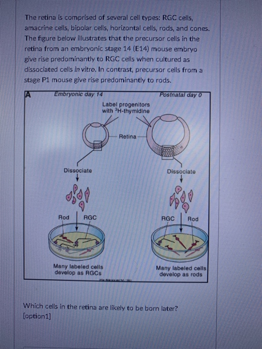 Solved The retina is comprised of several cell types: RGC | Chegg.com
