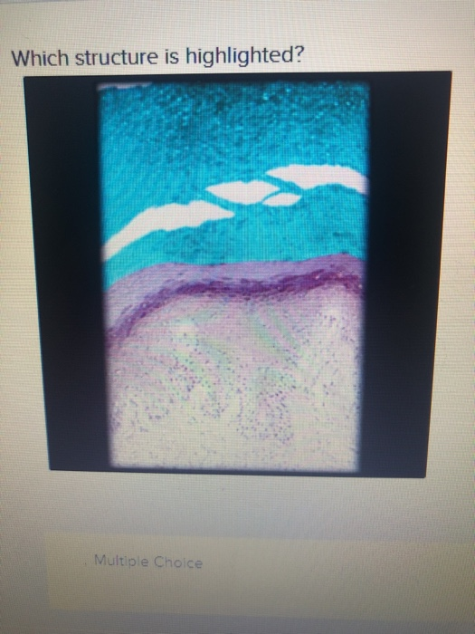 Solved Which structure is highlighted? Multiple Choice | Chegg.com