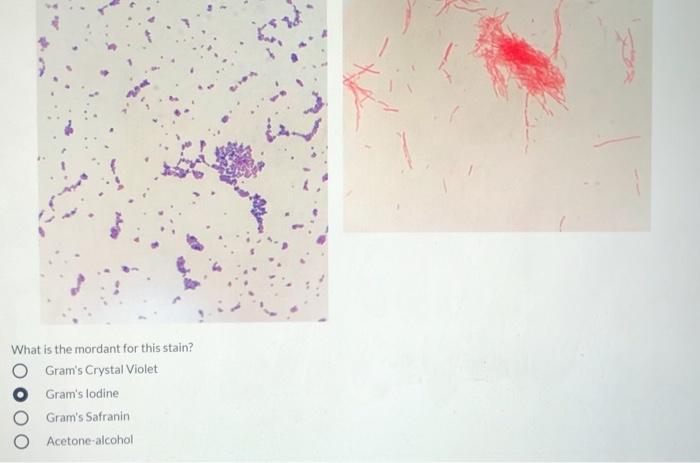Solved What is the primary stain? Gram's Safranin Gram's | Chegg.com