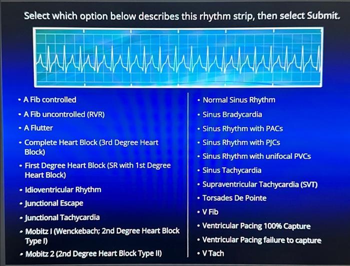 Solved Select which option below describes this rhythm | Chegg.com