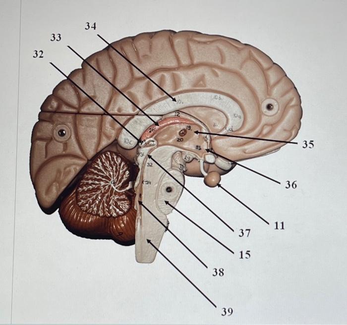Solved Identify the brain STRUCTURES | Chegg.com