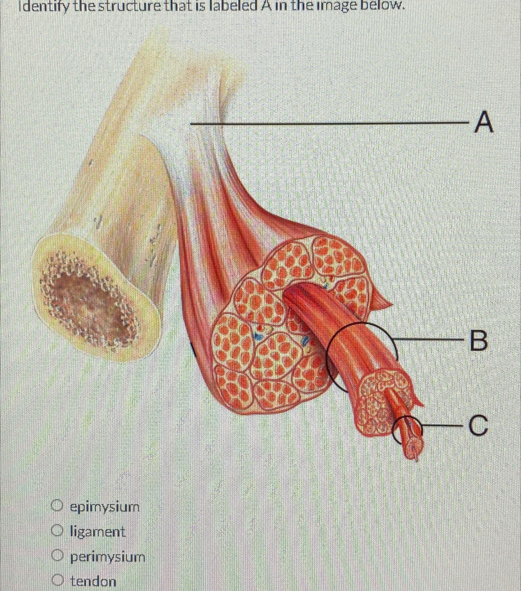 Solved Identify the structure that is labeled A in the image | Chegg.com