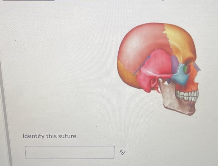 Solved Identify this bone Identify this suture. Identify | Chegg.com