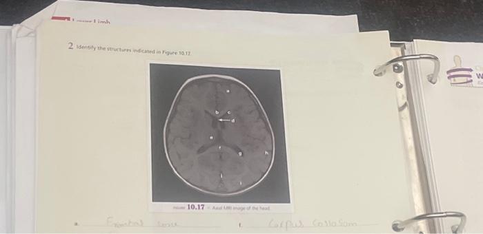 Solved Mr Limh 2 Identify the structures indicated in Figure | Chegg.com
