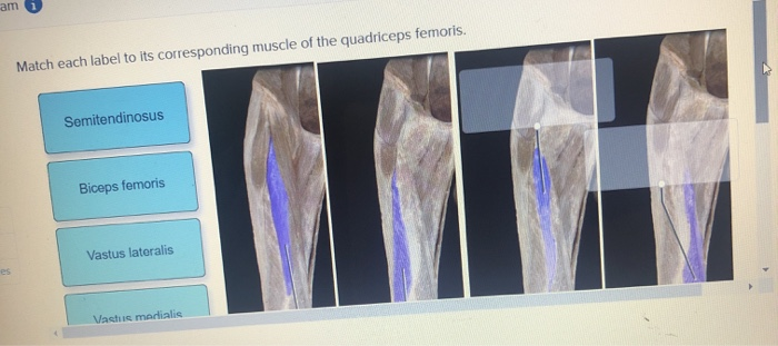 Solved am Match each label to its corresponding muscle of | Chegg.com