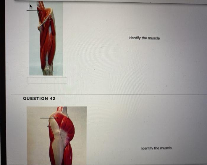 Solved Identify the muscle QUESTION 42 Identify the muscle | Chegg.com