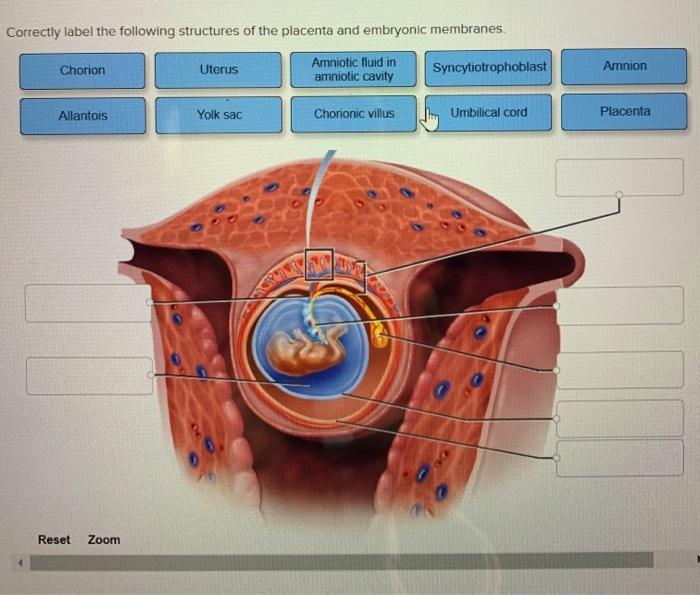Solved Correctly label the following structures of the | Chegg.com