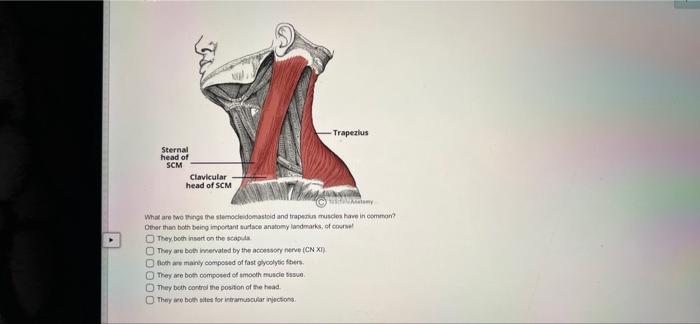 Solved Trapezius Sternal head of SCM Clavicular head of SCM | Chegg.com