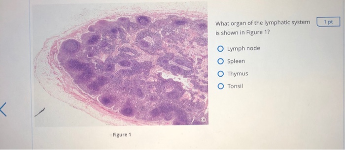 Solved (1 pt What organ of the lymphatic system is shown in | Chegg.com