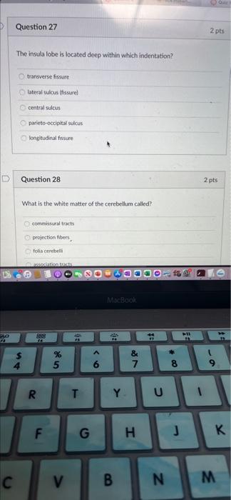Solved Question 26 2 pts Which dural partition extends into | Chegg.com