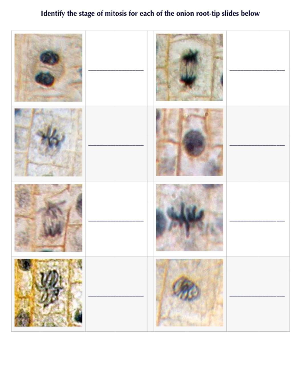 Solved Identify The Stage Of Mitosis For Each Of The Onion Chegg