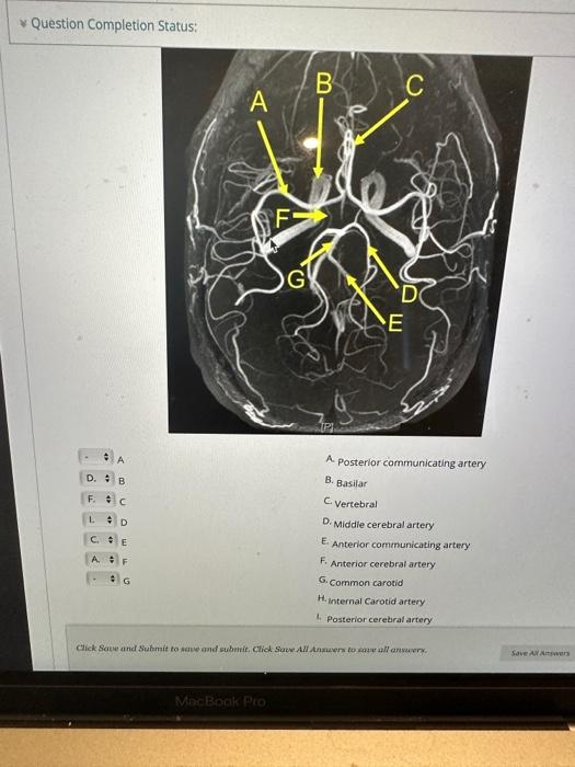 Solved Question Completion Status: A B c D E F G A. | Chegg.com