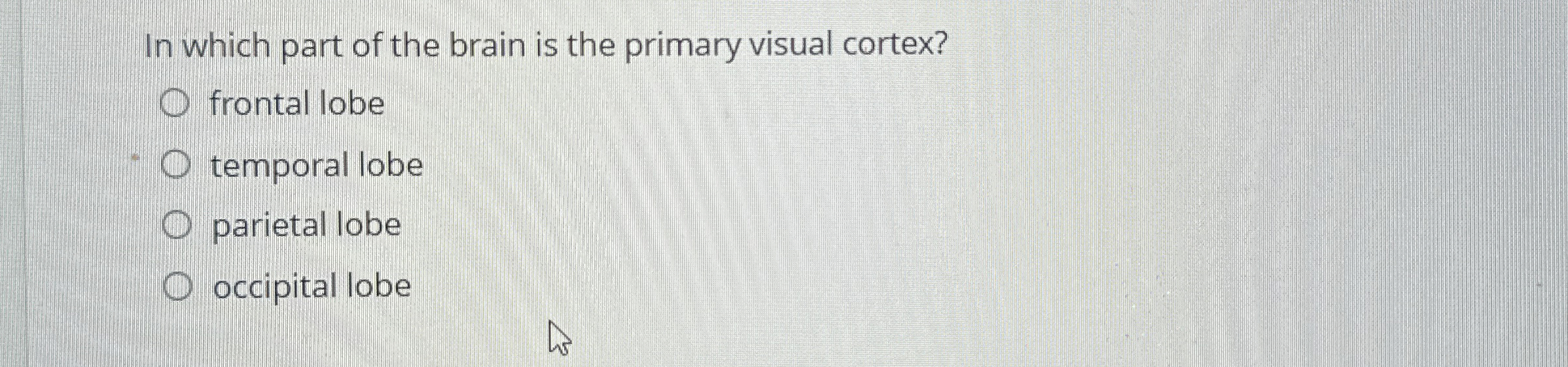 Solved In which part of the brain is the primary visual | Chegg.com