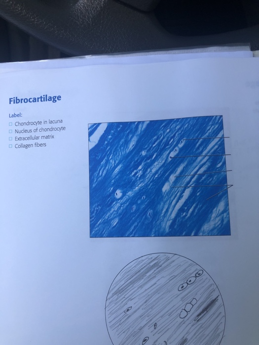 Solved Fibrocartilage Label: Chondrocyte in lacuna Nucleus | Chegg.com